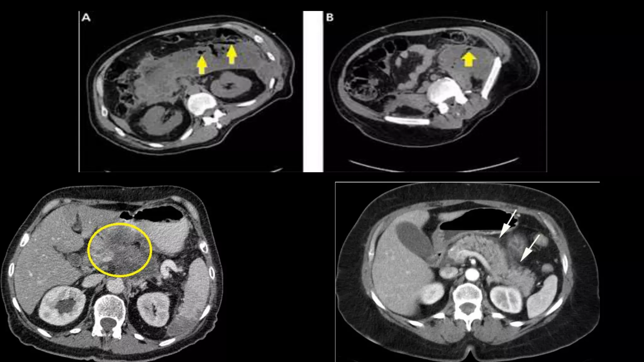 Abdominal CT scan, Triphasic CT scan, Abdominal Anatomy and ...