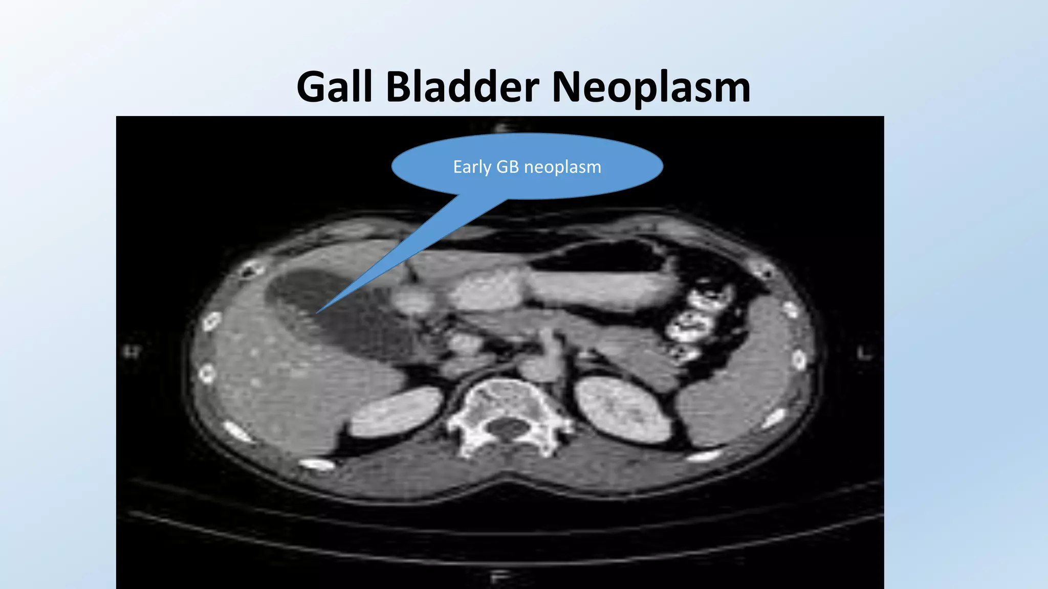 Abdominal CT scan, Triphasic CT scan, Abdominal Anatomy and ...
