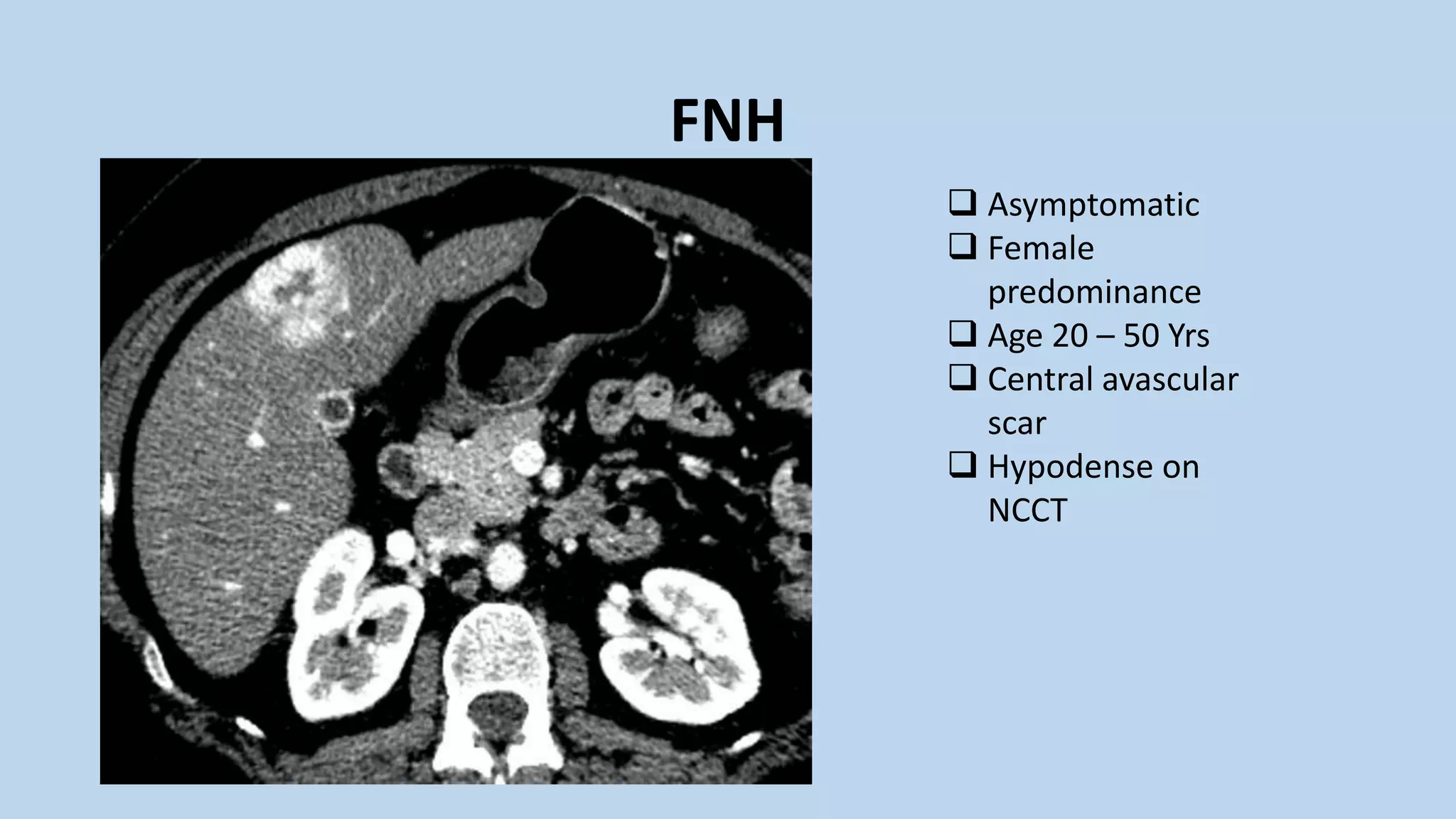 Abdominal CT scan, Triphasic CT scan, Abdominal Anatomy and ...