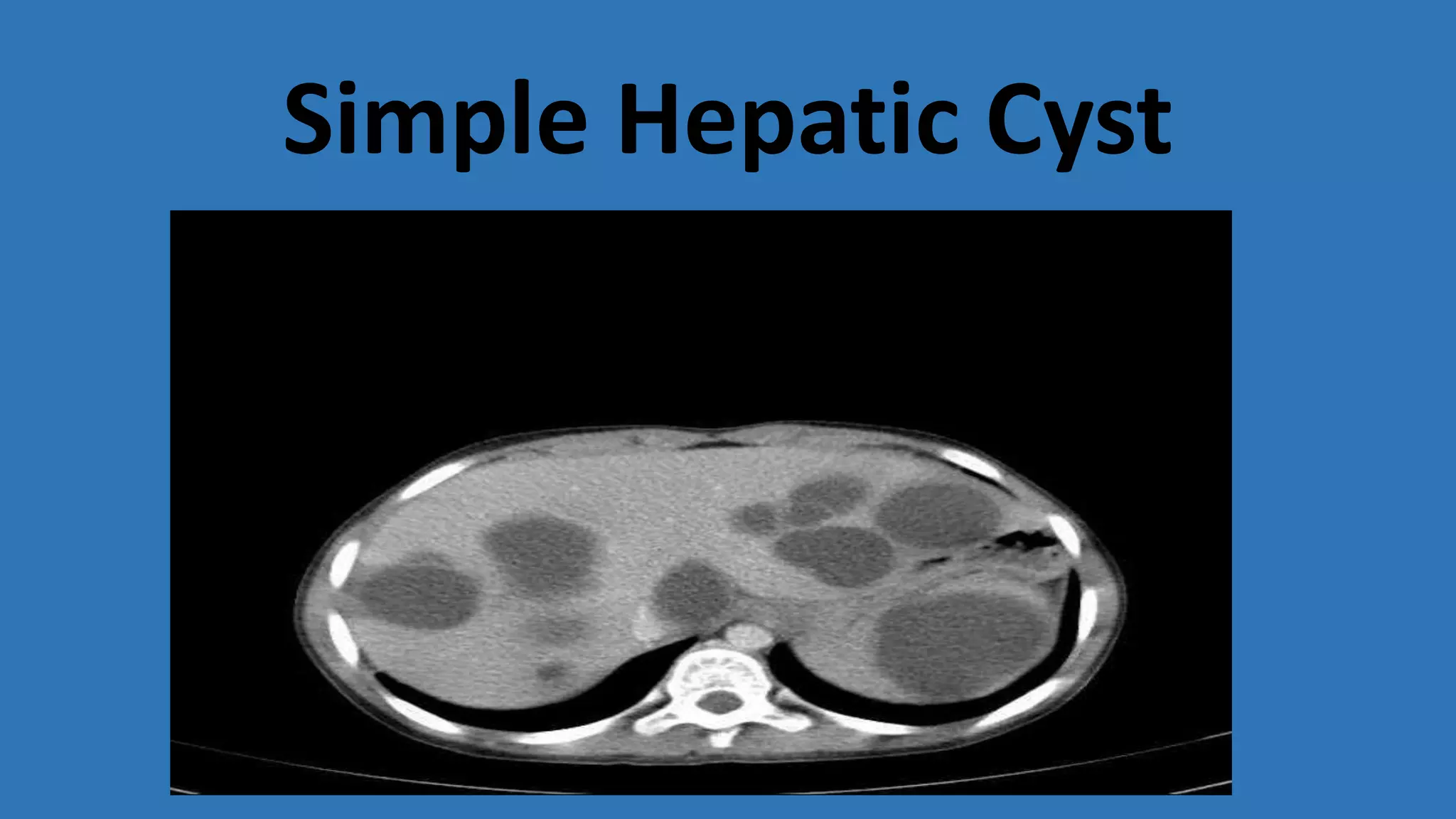 Abdominal CT scan, Triphasic CT scan, Abdominal Anatomy and ...