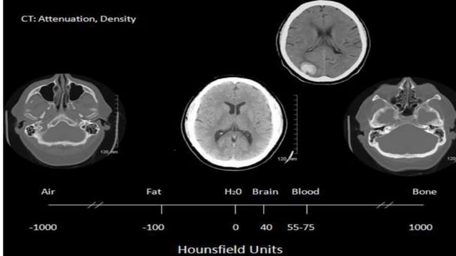 Abdominal CT scan, Triphasic CT scan, Abdominal Anatomy and ...