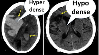 Abdominal CT scan, Triphasic CT scan, Abdominal Anatomy and ...