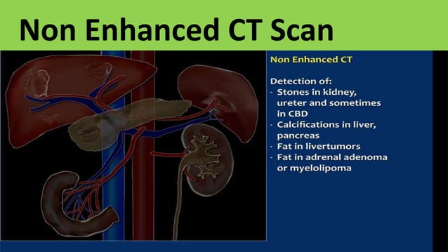 Abdominal CT scan, Triphasic CT scan, Abdominal Anatomy and ...