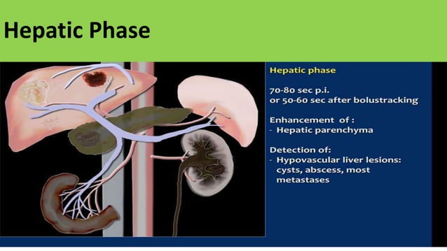 Abdominal CT scan, Triphasic CT scan, Abdominal Anatomy and ...