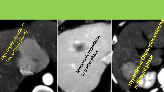 Abdominal CT scan, Triphasic CT scan, Abdominal Anatomy and ...
