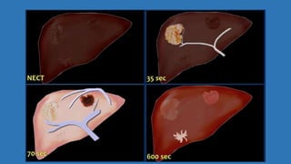 Abdominal CT scan, Triphasic CT scan, Abdominal Anatomy and ...