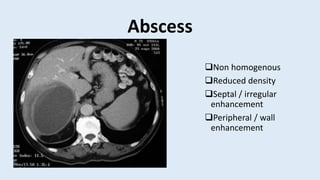Abdominal CT scan, Triphasic CT scan, Abdominal Anatomy and ...