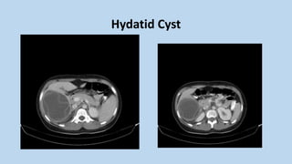 Abdominal CT scan, Triphasic CT scan, Abdominal Anatomy and ...