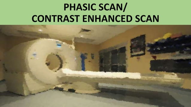 Abdominal Ct Scan Triphasic Ct Scan Abdominal Anatomy And