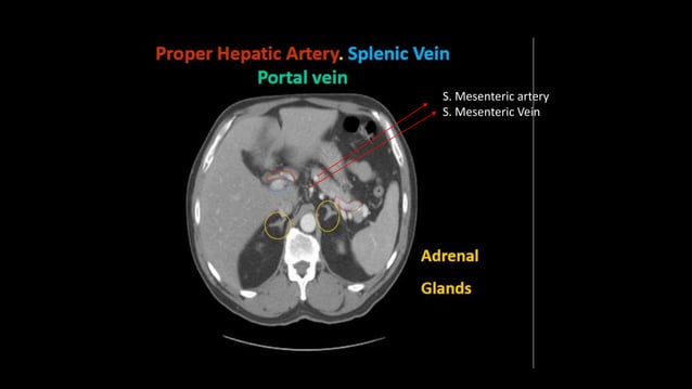 Abdominal Ct Scan Triphasic Ct Scan Abdominal Anatomy And