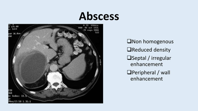 Abdominal Ct Scan Triphasic Ct Scan Abdominal Anatomy And