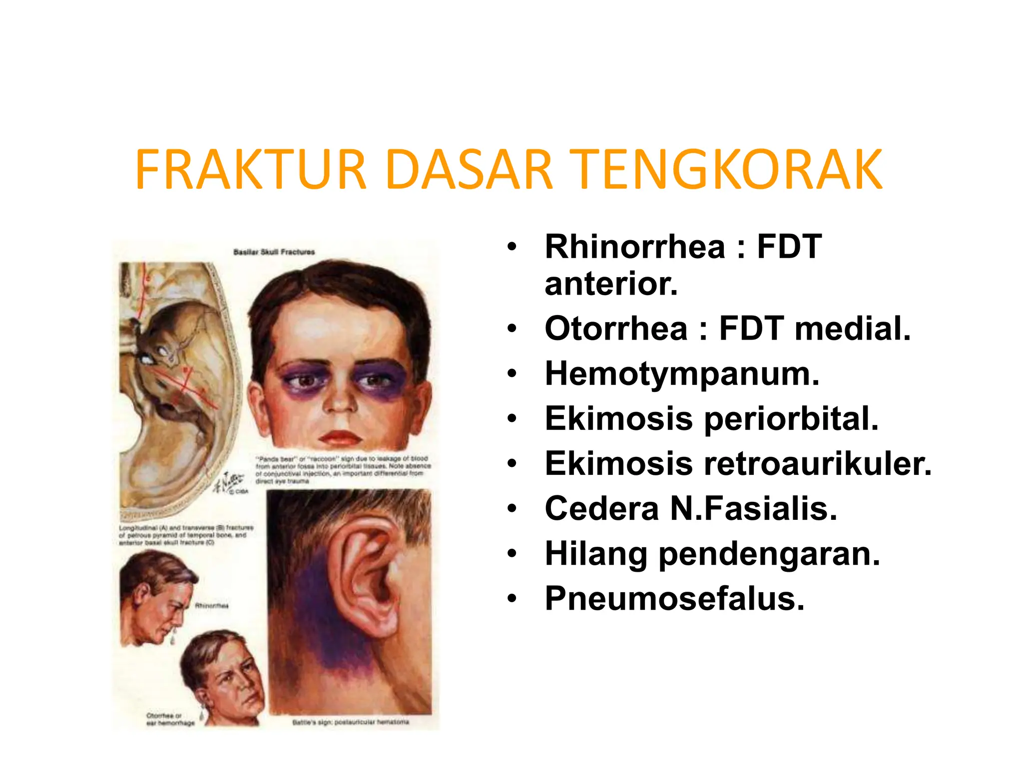 cedera kepala macam macam dan tatalaksana.pptx