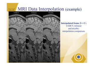 Image Interpolation | PDF