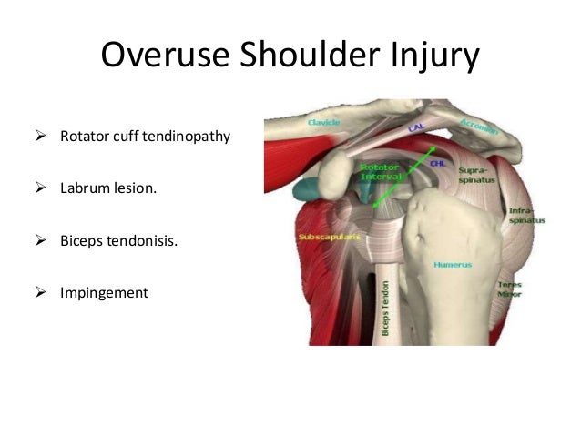 Overuse injurues in overhead athletes 3