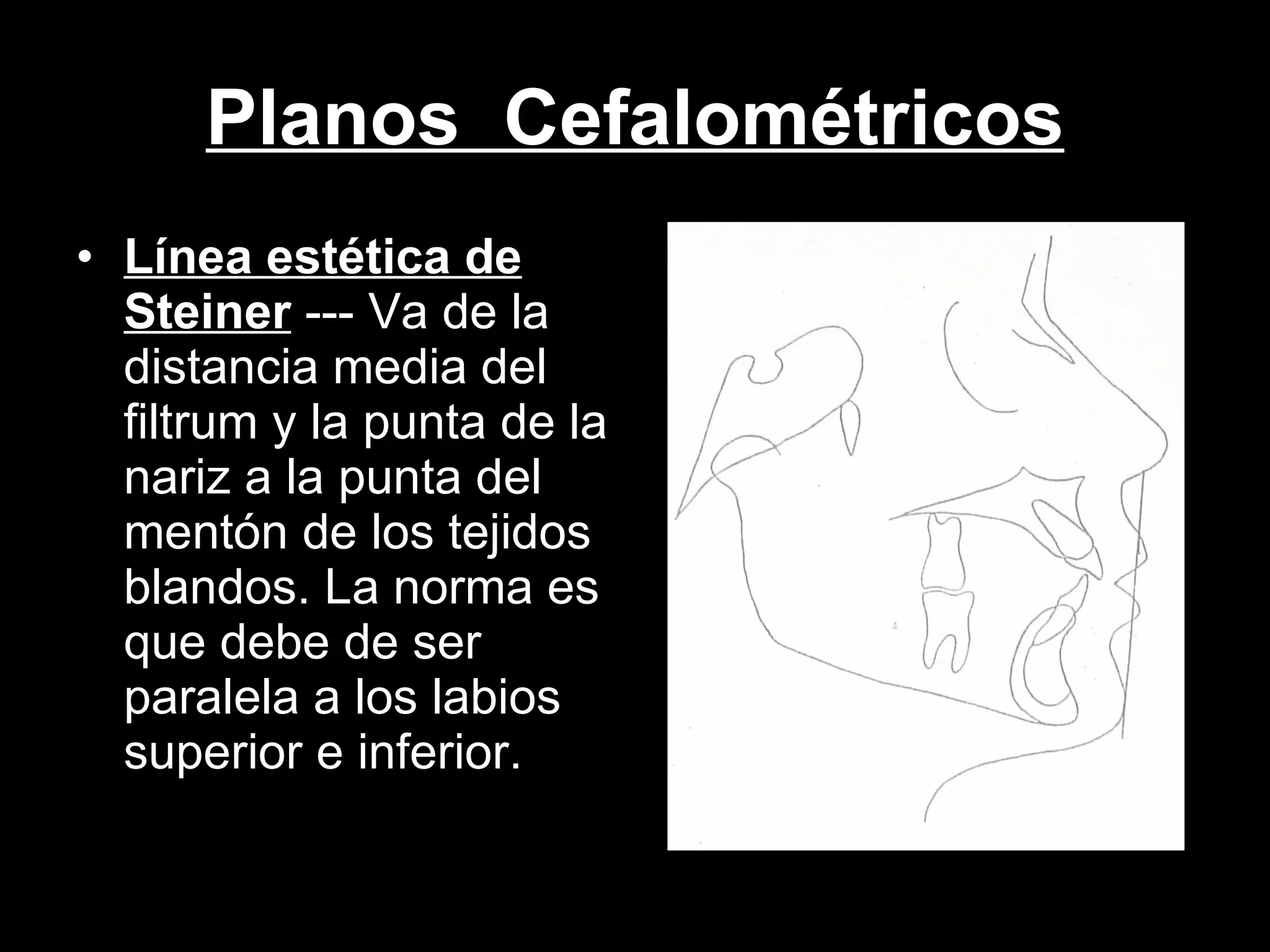 Cefalometria de Steiner | PPT