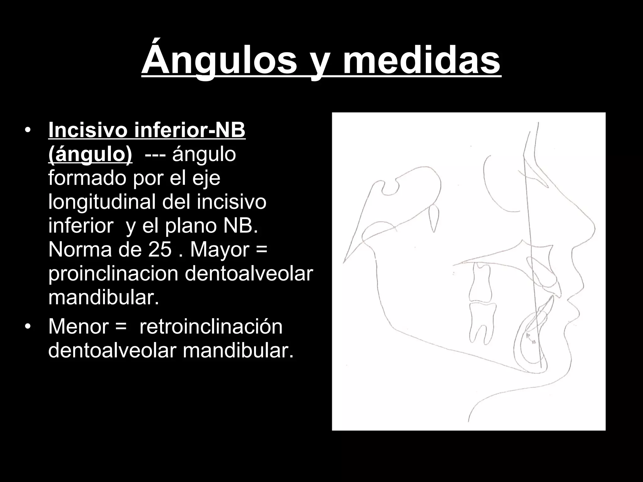 Cefalometria de Steiner | PPT