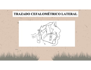 CEFALOMETRIa ortodoncia medición cefalometria | PDF