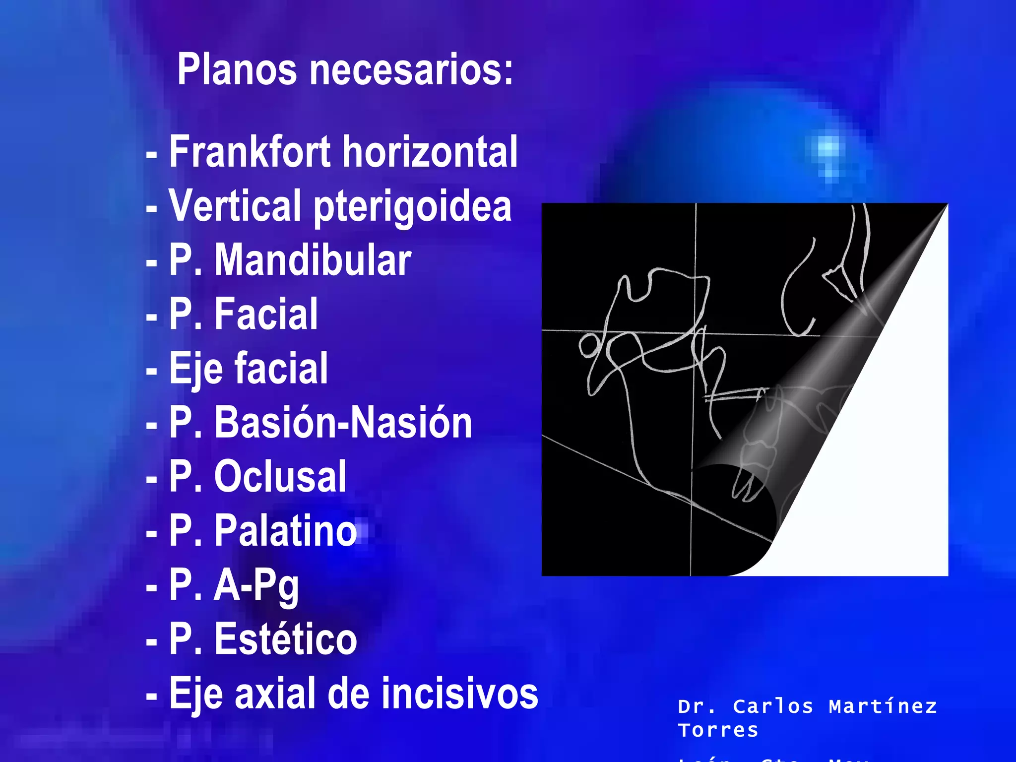 CEFALOMETRIA DE RICKETTS, LATERAL | PPT