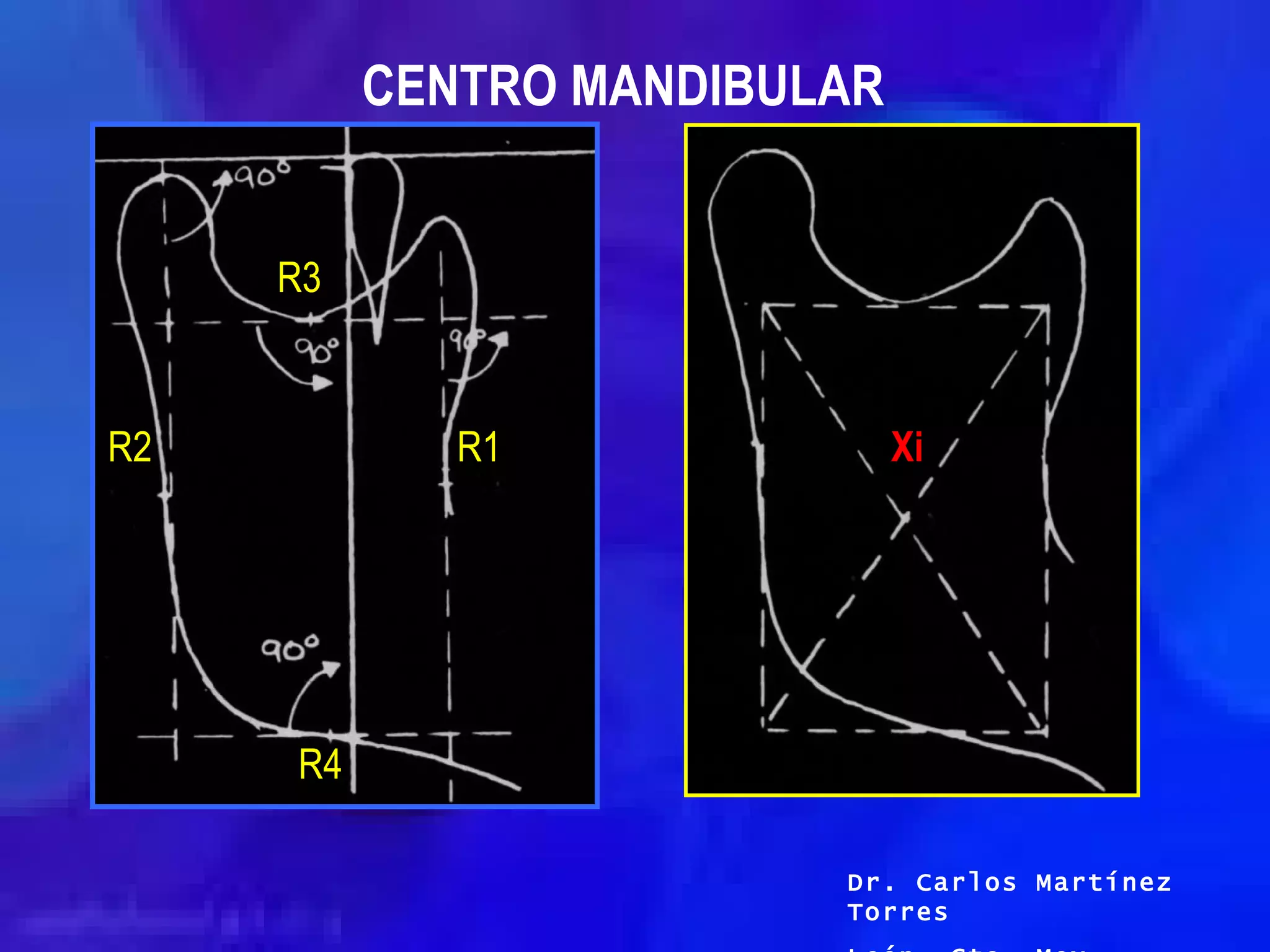 CEFALOMETRIA DE RICKETTS, LATERAL | PPT
