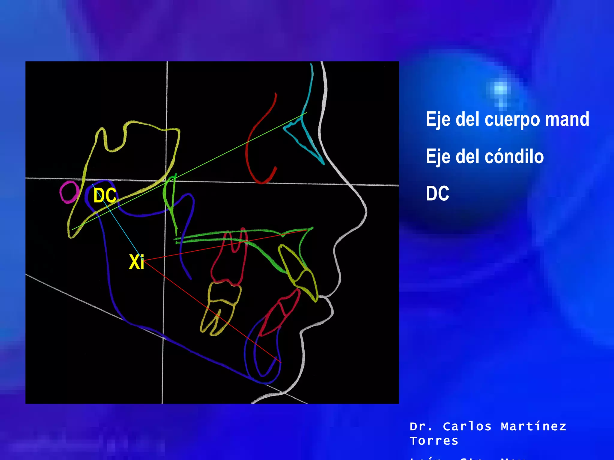 CEFALOMETRIA DE RICKETTS, LATERAL | PPT