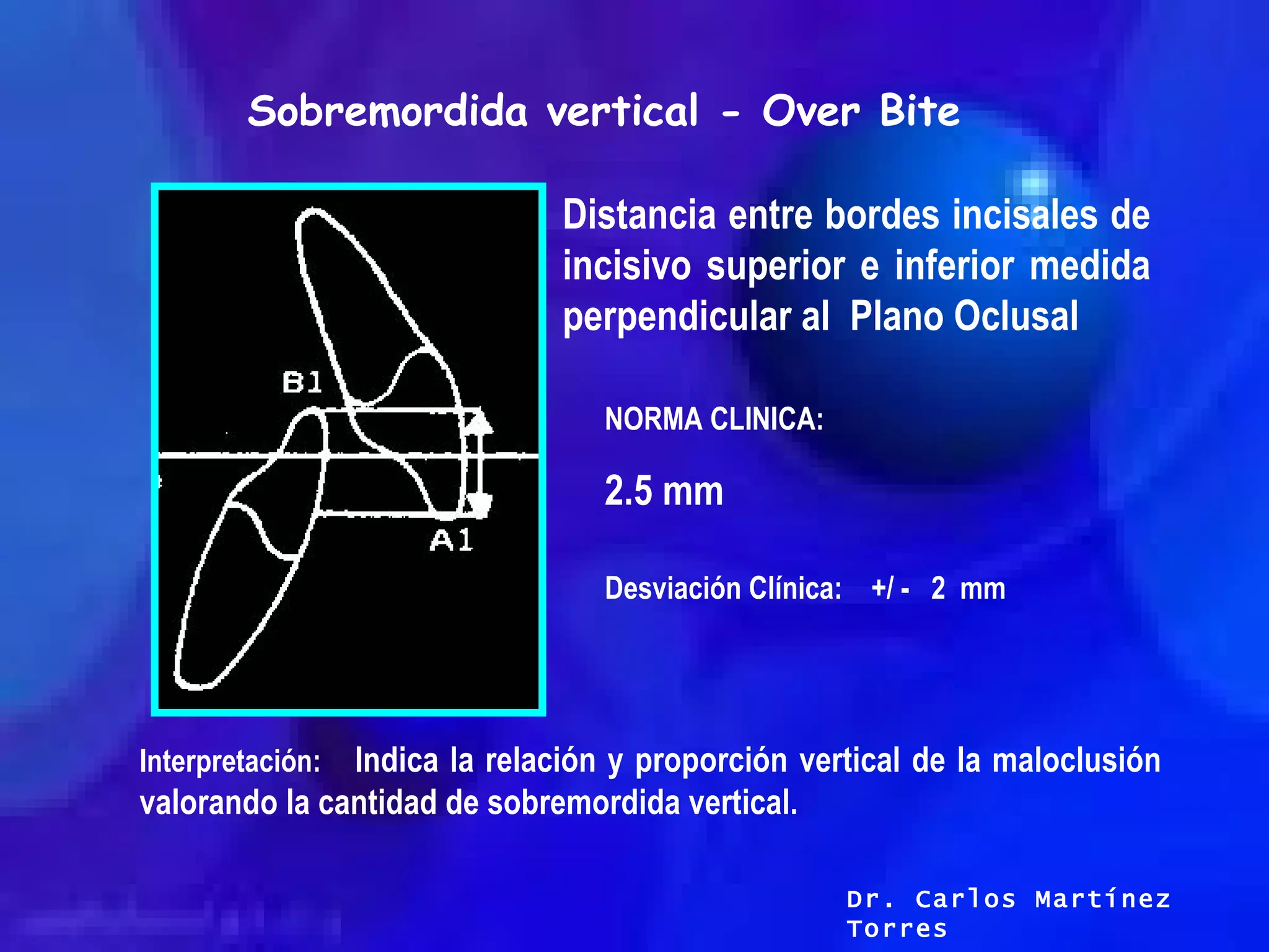 Cefalometria De Ricketts Lateral Ppt