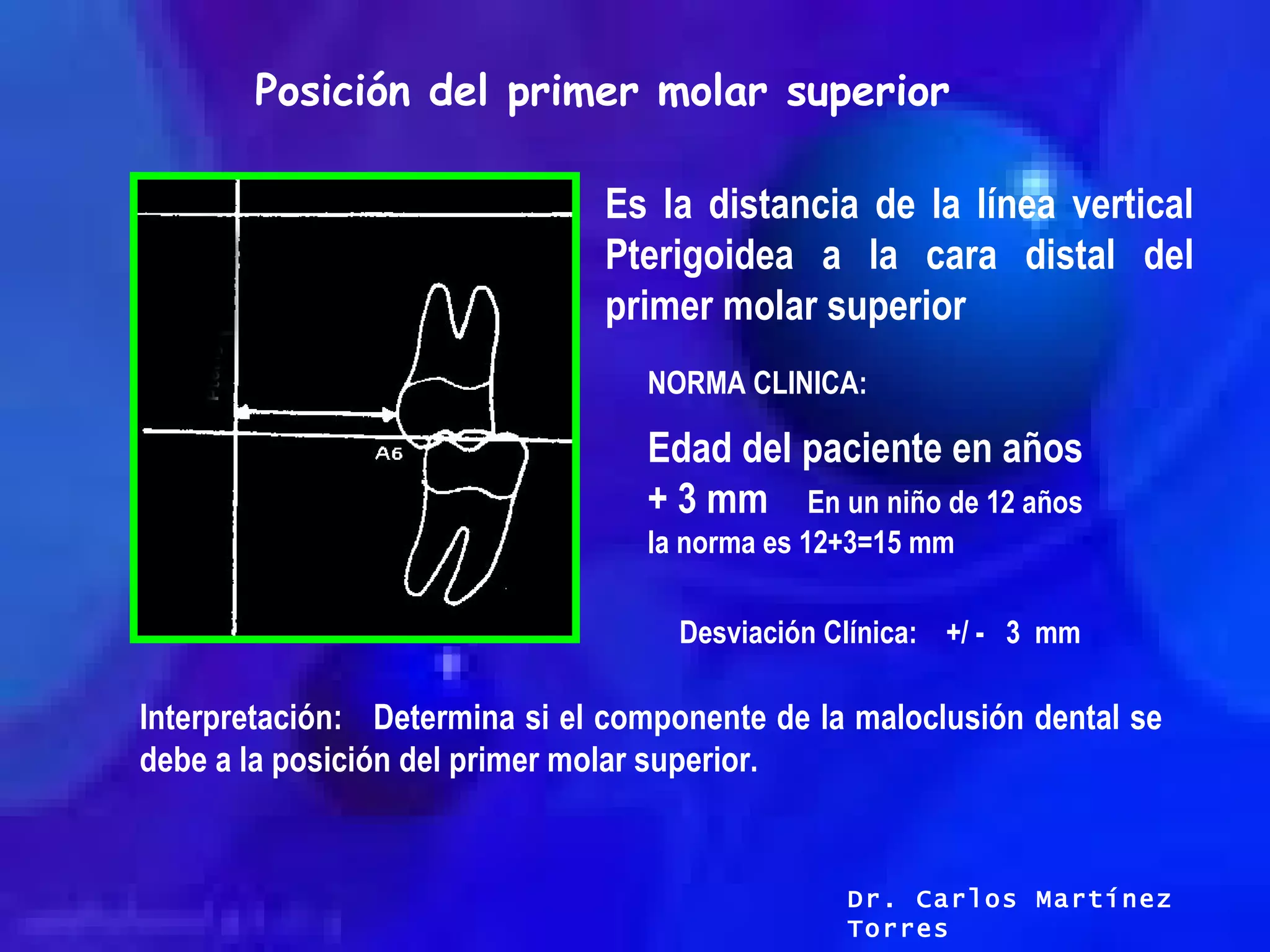 CEFALOMETRIA DE RICKETTS, LATERAL | PPT