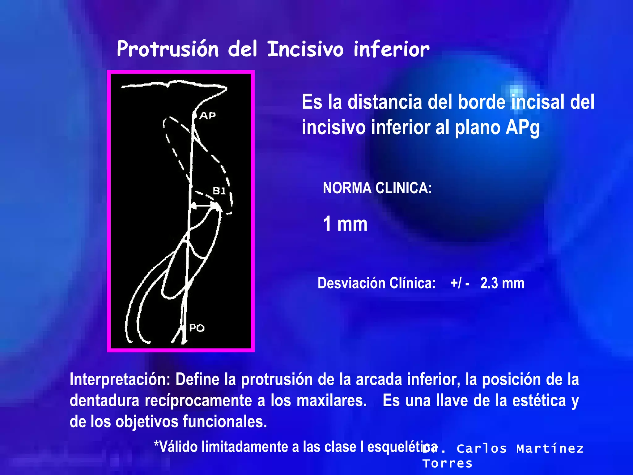 CEFALOMETRIA DE RICKETTS, LATERAL | PPT