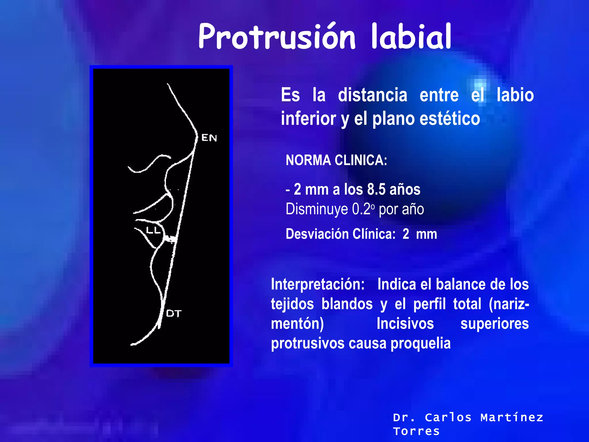 CEFALOMETRIA DE RICKETTS, LATERAL | PPT