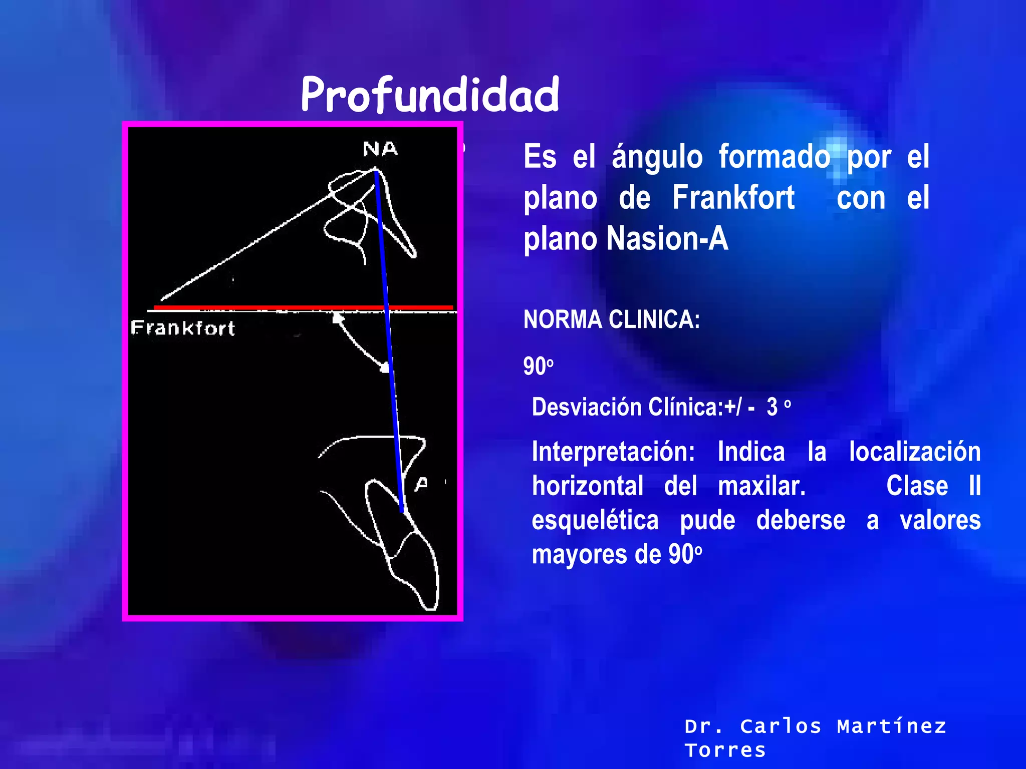 CEFALOMETRIA DE RICKETTS, LATERAL | PPT