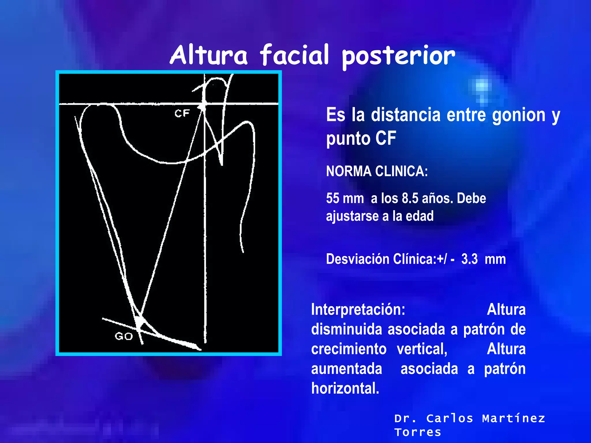 CEFALOMETRIA DE RICKETTS, LATERAL | PPT