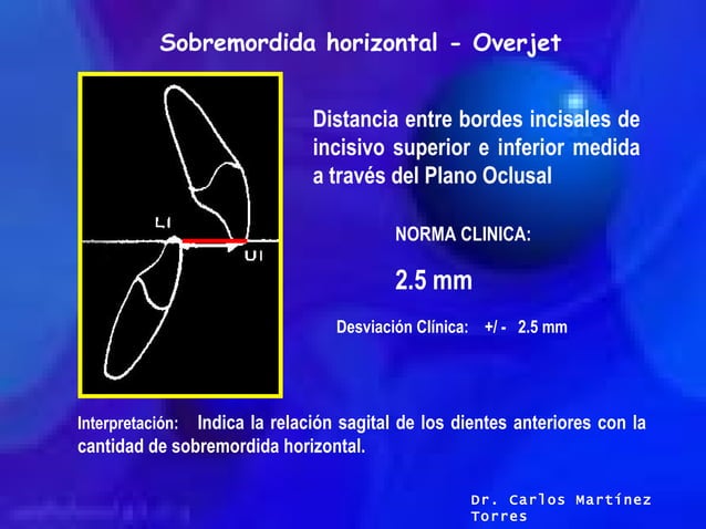 CEFALOMETRIA DE RICKETTS, LATERAL | PPT