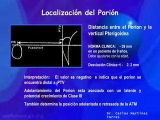 CEFALOMETRIA DE RICKETTS, LATERAL | PPT