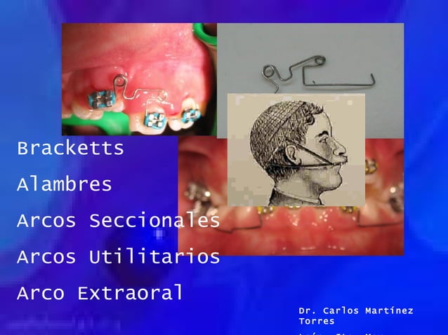 CEFALOMETRIA DE RICKETTS, LATERAL | PPT