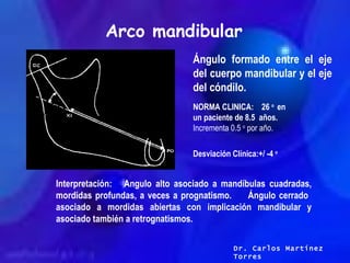 CEFALOMETRIA DE RICKETTS, LATERAL | PPT