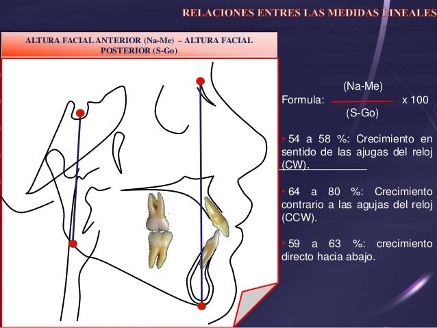 Cefalometria Björk Jarabak