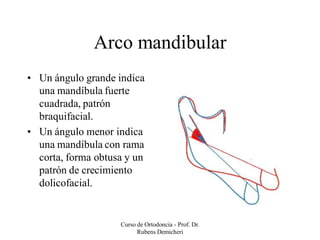 Cefalometria de Rickets - Análisis básico | PDF