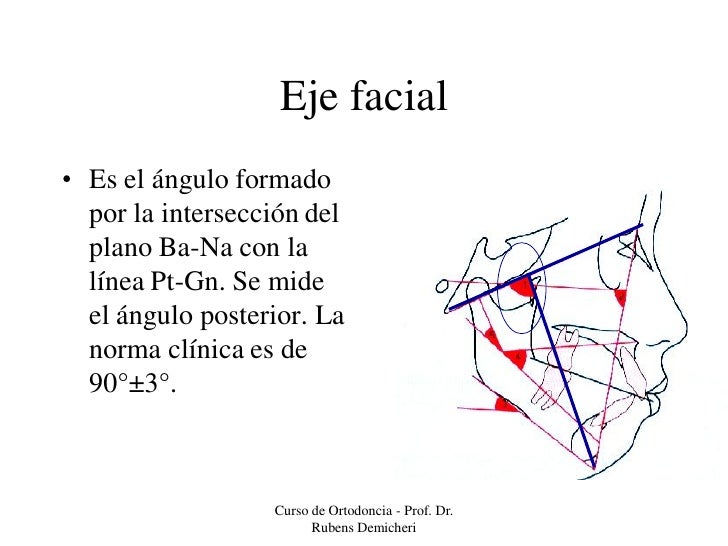 Cefalometria de Rickets - Análisis básico