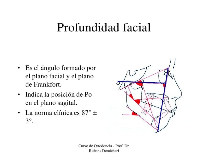 Cefalometria de Rickets - Análisis básico