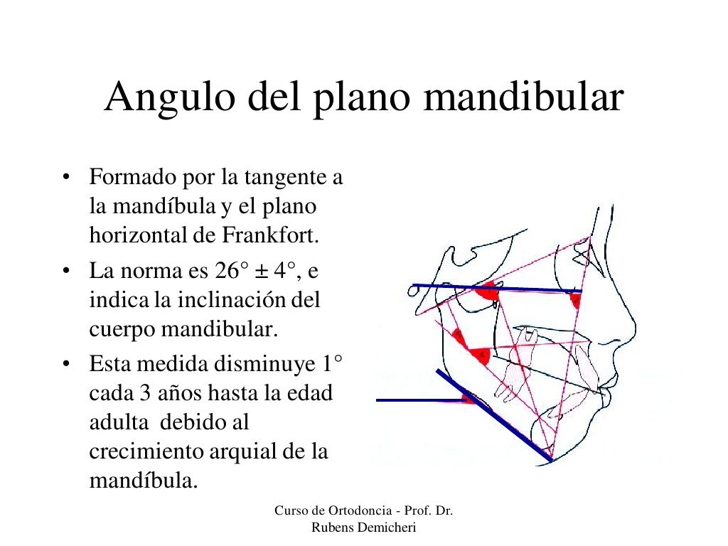 Cefalometria de Rickets - Análisis básico