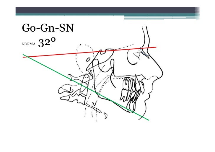 Cefalometria De Steiner