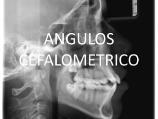 Cefalometria dr. huete 025 | PPTX