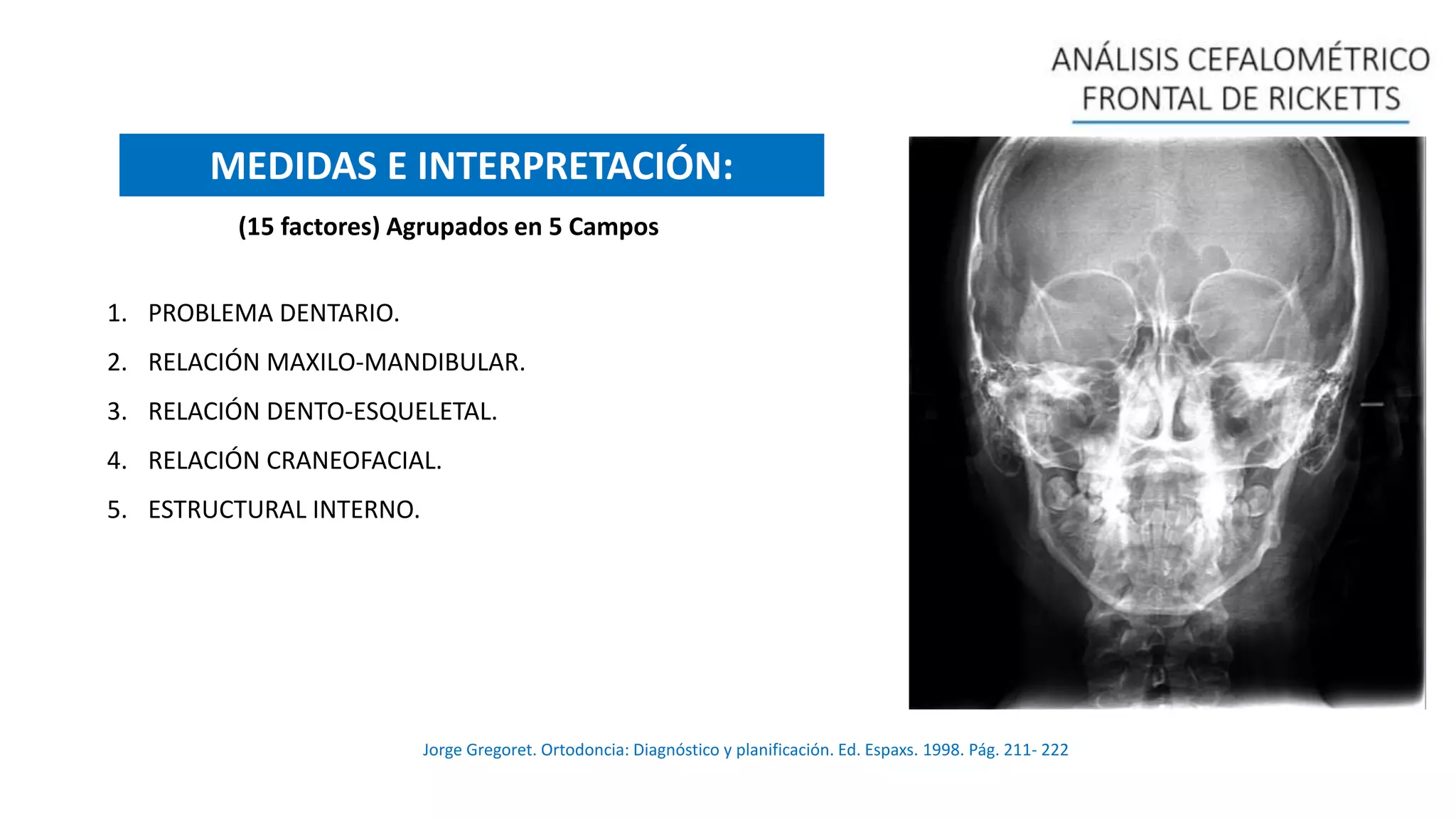 Cefalometria frontal ricketts | PPTX