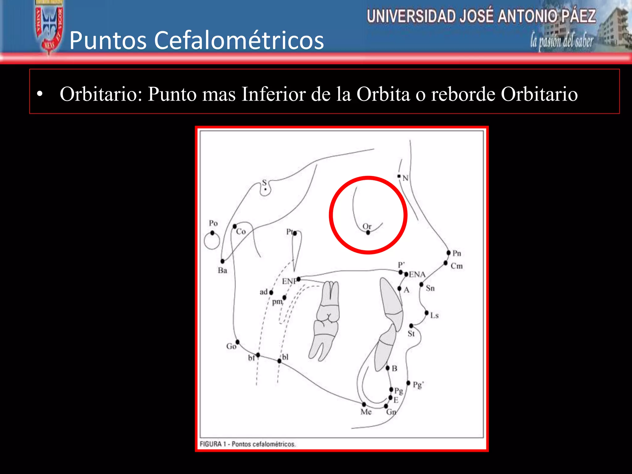 Cefalometria_Puntos_Planos_y_Angulos.ppt