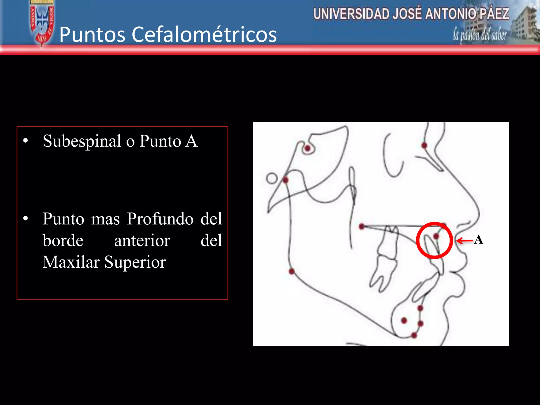 Cefalometria_Puntos_Planos_y_Angulos.ppt