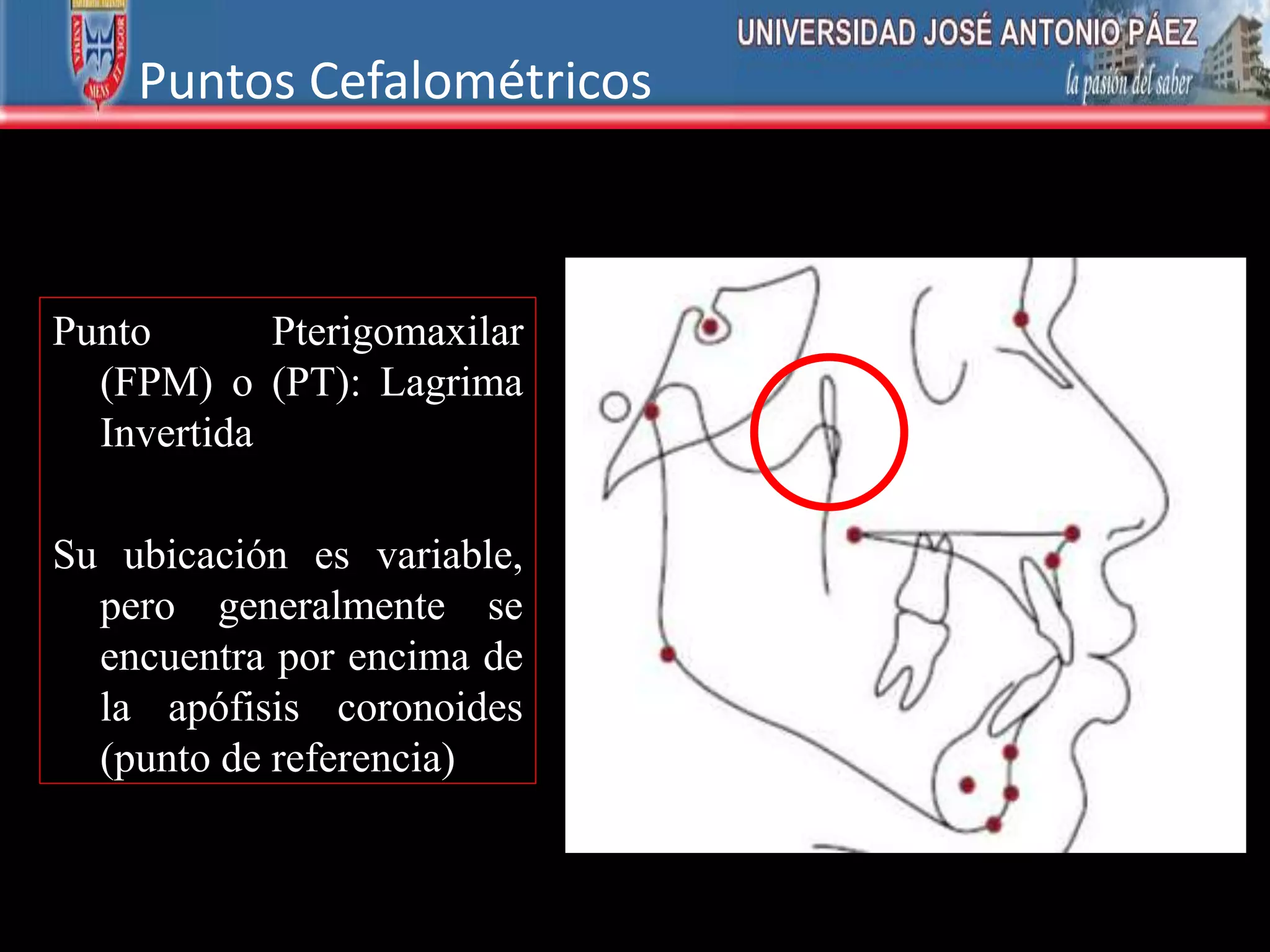 Cefalometria_Puntos_Planos_y_Angulos.ppt