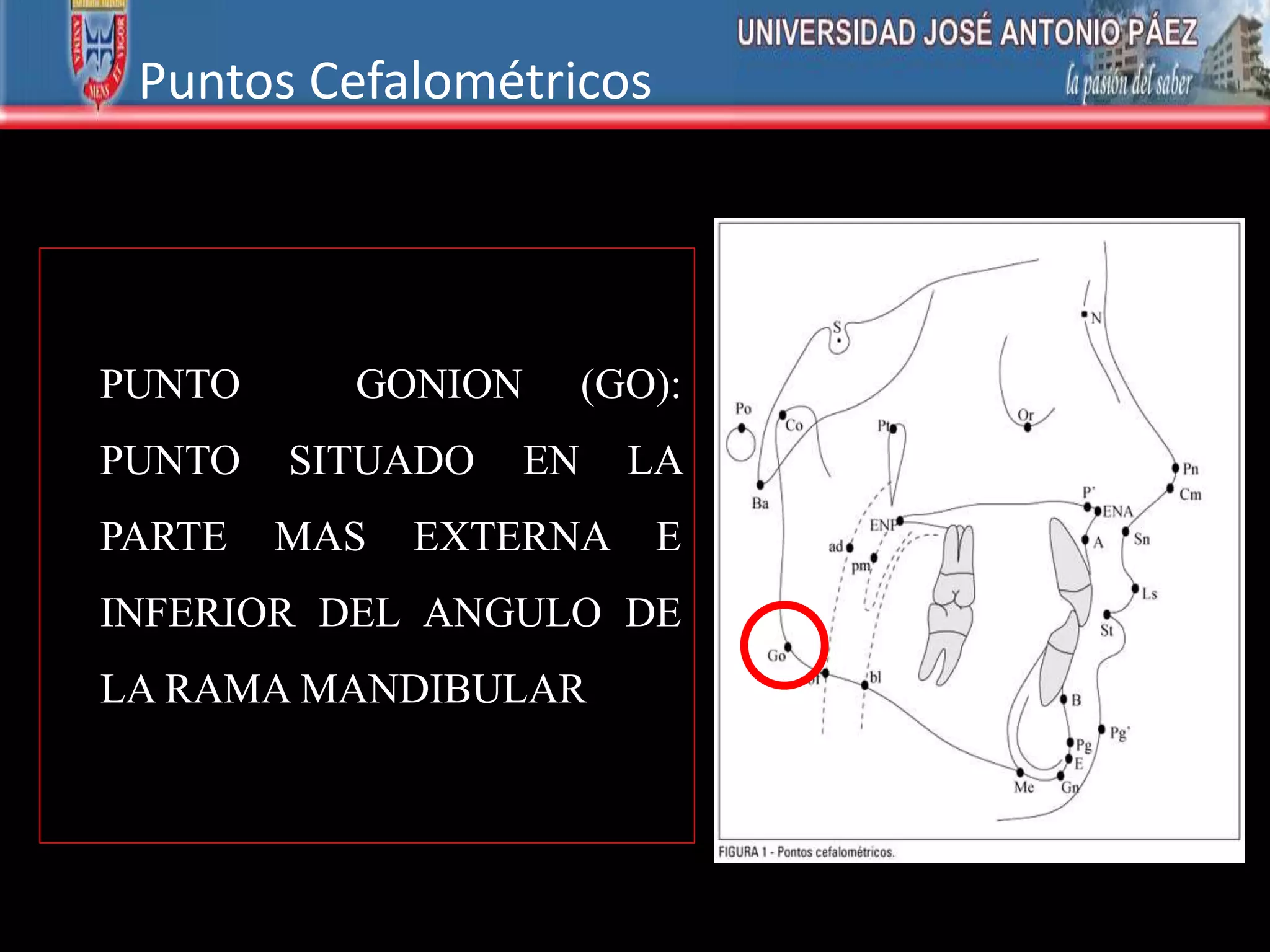 Cefalometria_Puntos_Planos_y_Angulos.ppt