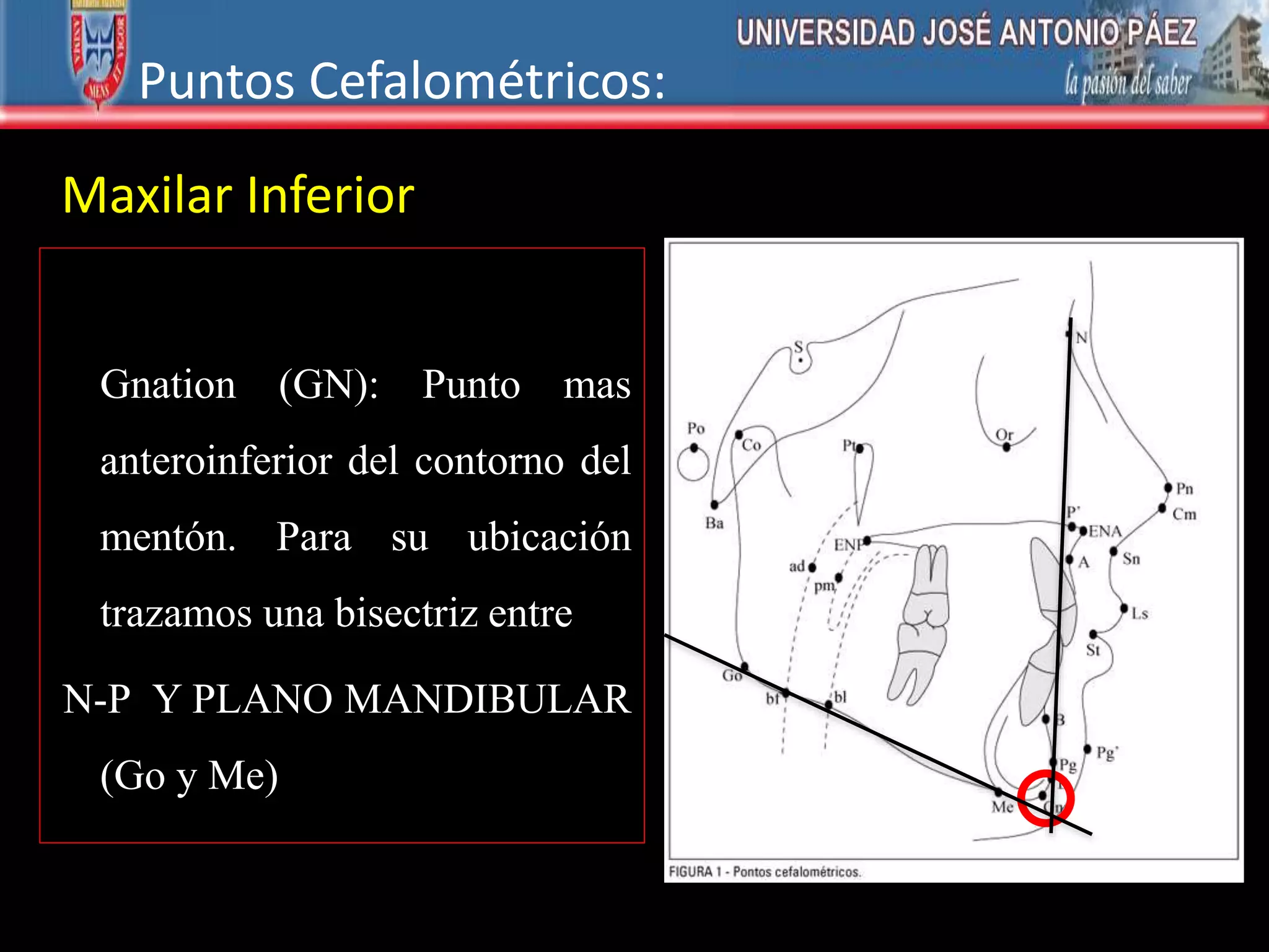 Cefalometria_Puntos_Planos_y_Angulos.ppt