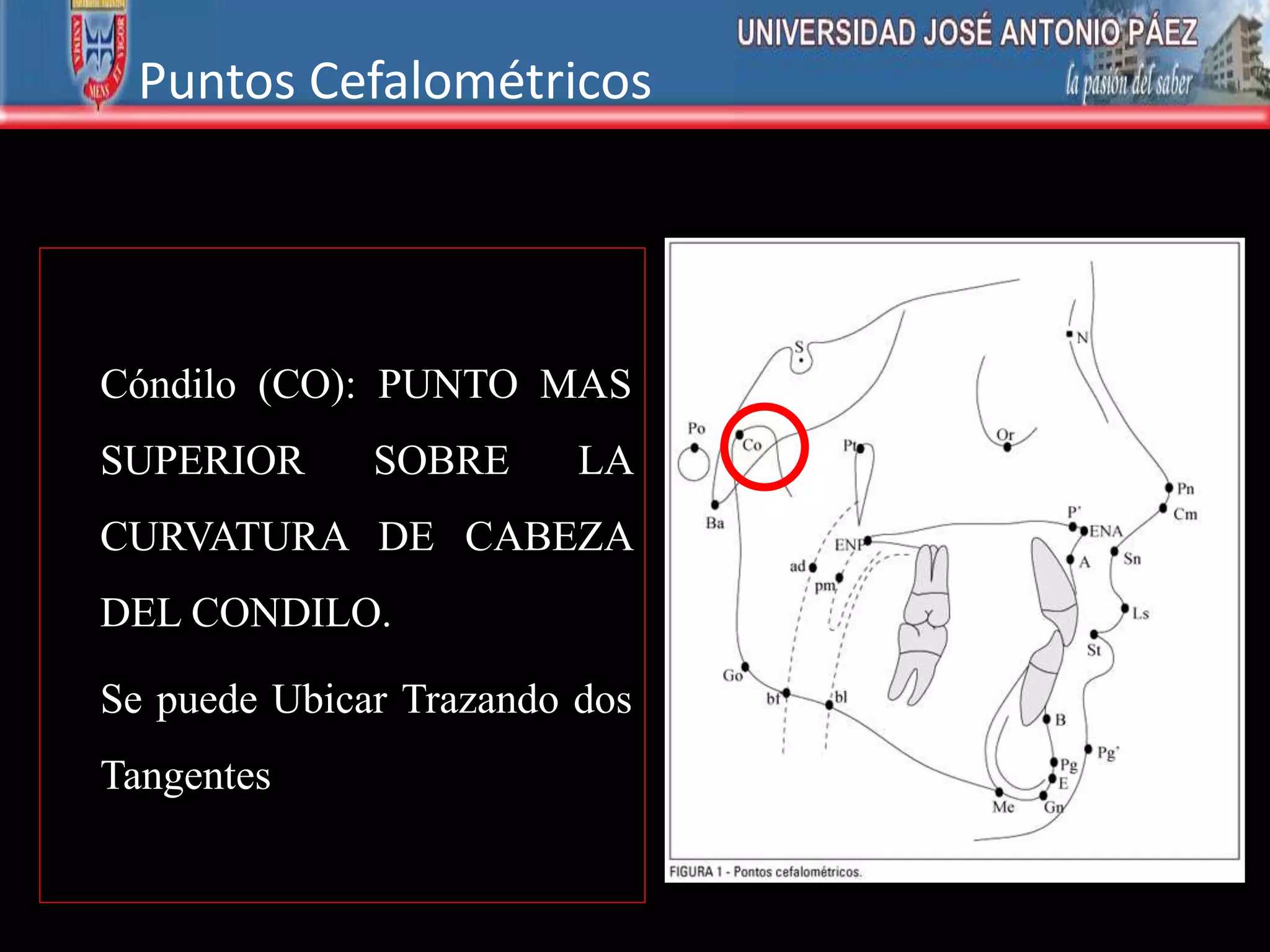 Cefalometria_Puntos_Planos_y_Angulos.ppt