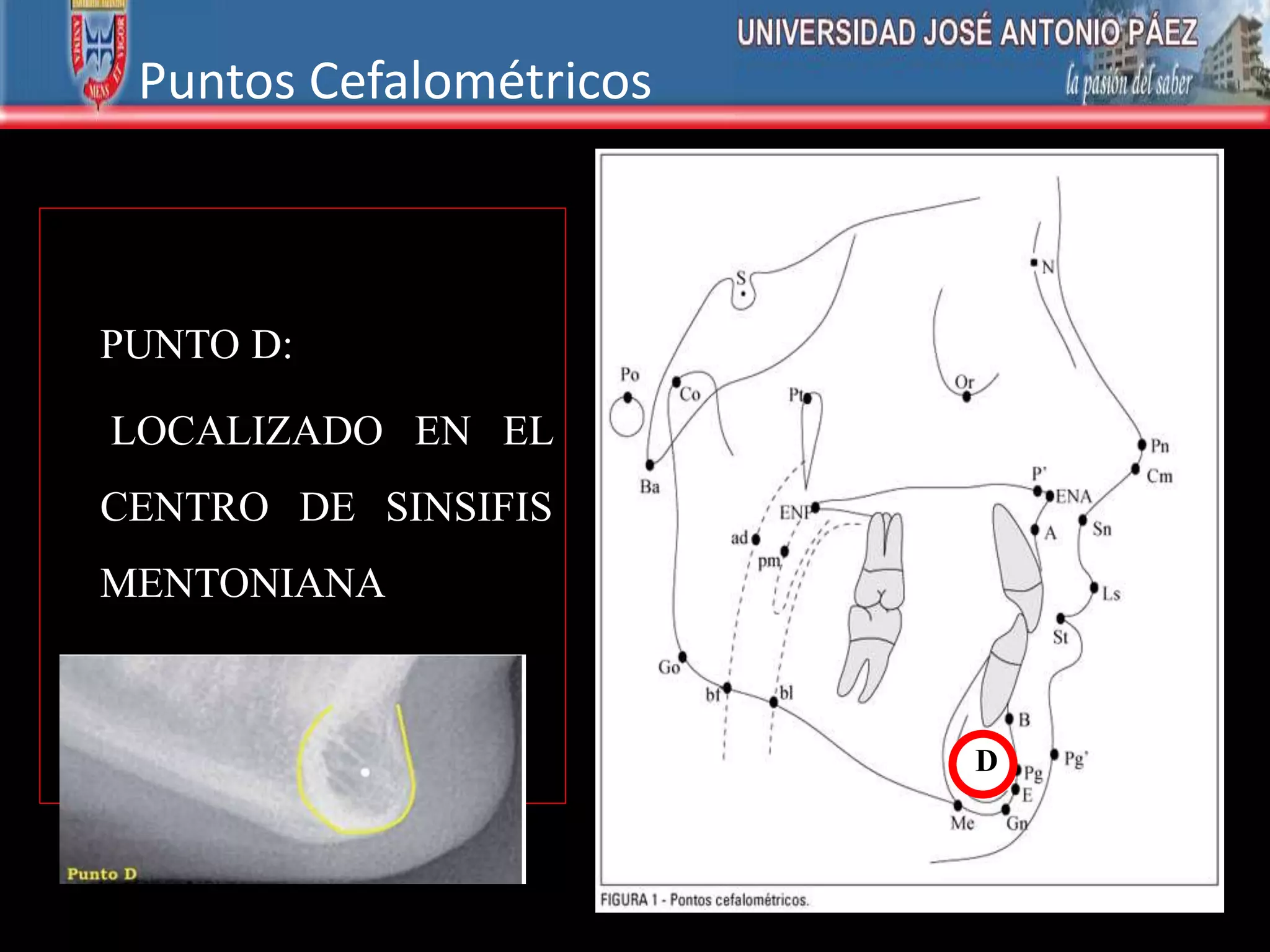 Cefalometria_Puntos_Planos_y_Angulos.ppt