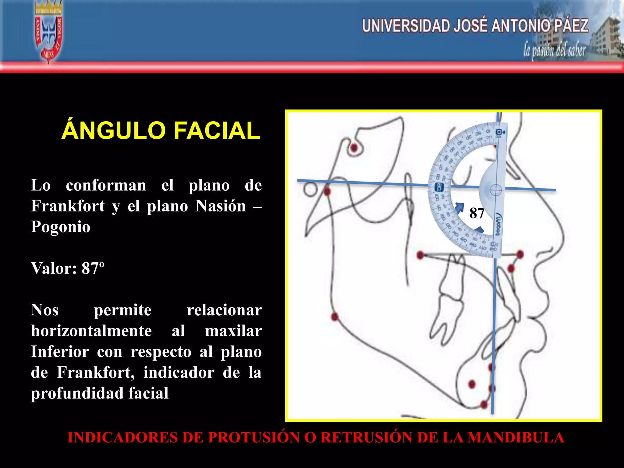 Cefalometria_Puntos_Planos_y_Angulos.ppt